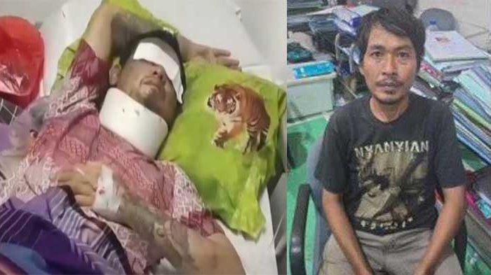 Motif Pelaku Congkel Mata Faisal di Bogor, Mengaku Marah Istrinya ...