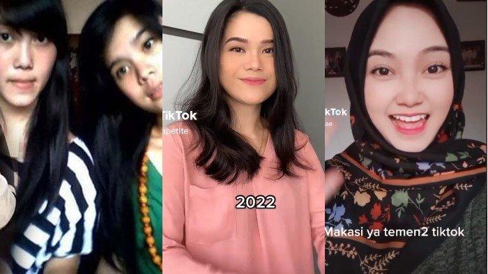 Masih Ingat Sinta dan Jojo Keong Racun? Mulai Eksis di TikTok, Terungkap Kondisi Keduanya Kini ...