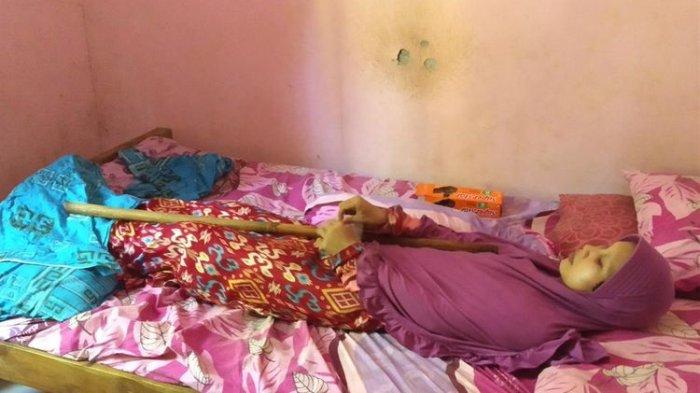 Kisah Sulami 'Manusia Kayu' yang Meninggal di Usia 42 Tahun, Kondisi ...