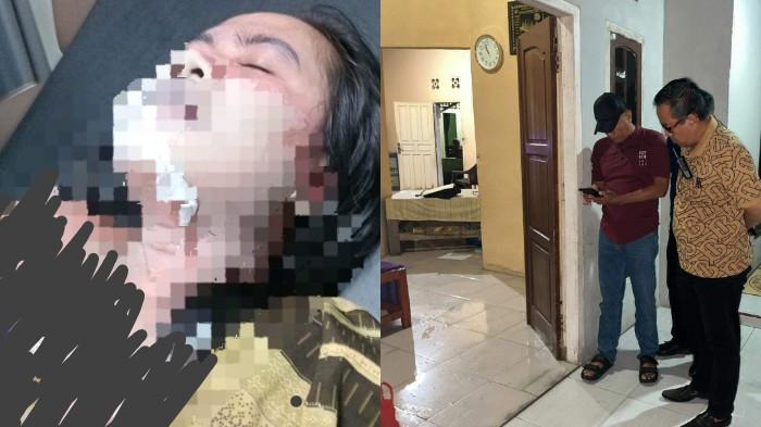 Sosok Ropi Yanti Korban Siraman Air Keras, Mengalami Luka Serius, Kakak ...