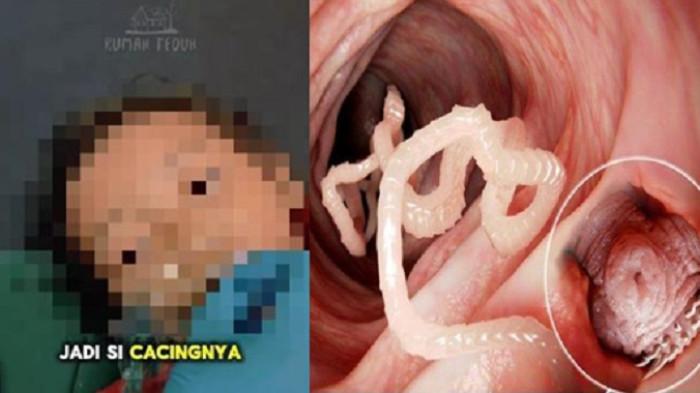 Sosok Raya, Balita di Sukabumi Meninggal Tubuh Dipenuhi Cacing, Orang Tuanya Keterbelakangan ...