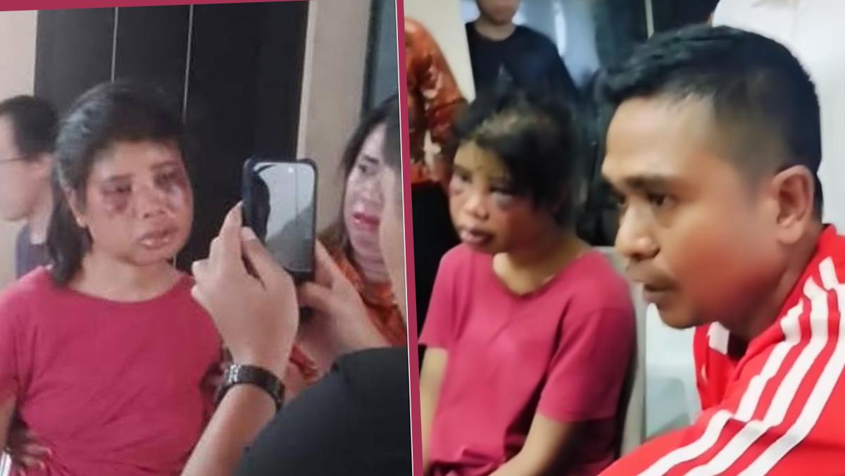 Kasus Majikan Siksa Pembantu di Batam, Psikolog: Ada Risiko Trauma ...