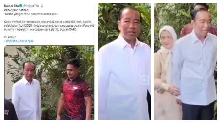 Dokter Tifa Ungkap Penyakit Jokowi Cukup Berat, Jangan Dikira Cuma Kudisan - Posbelitung.co