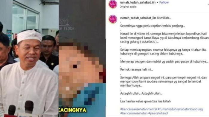 Pantas Dedi Mulyadi Tegur Keras Bupati Sukabumi, Raya Balita Tewas karena Cacingan Parah ...