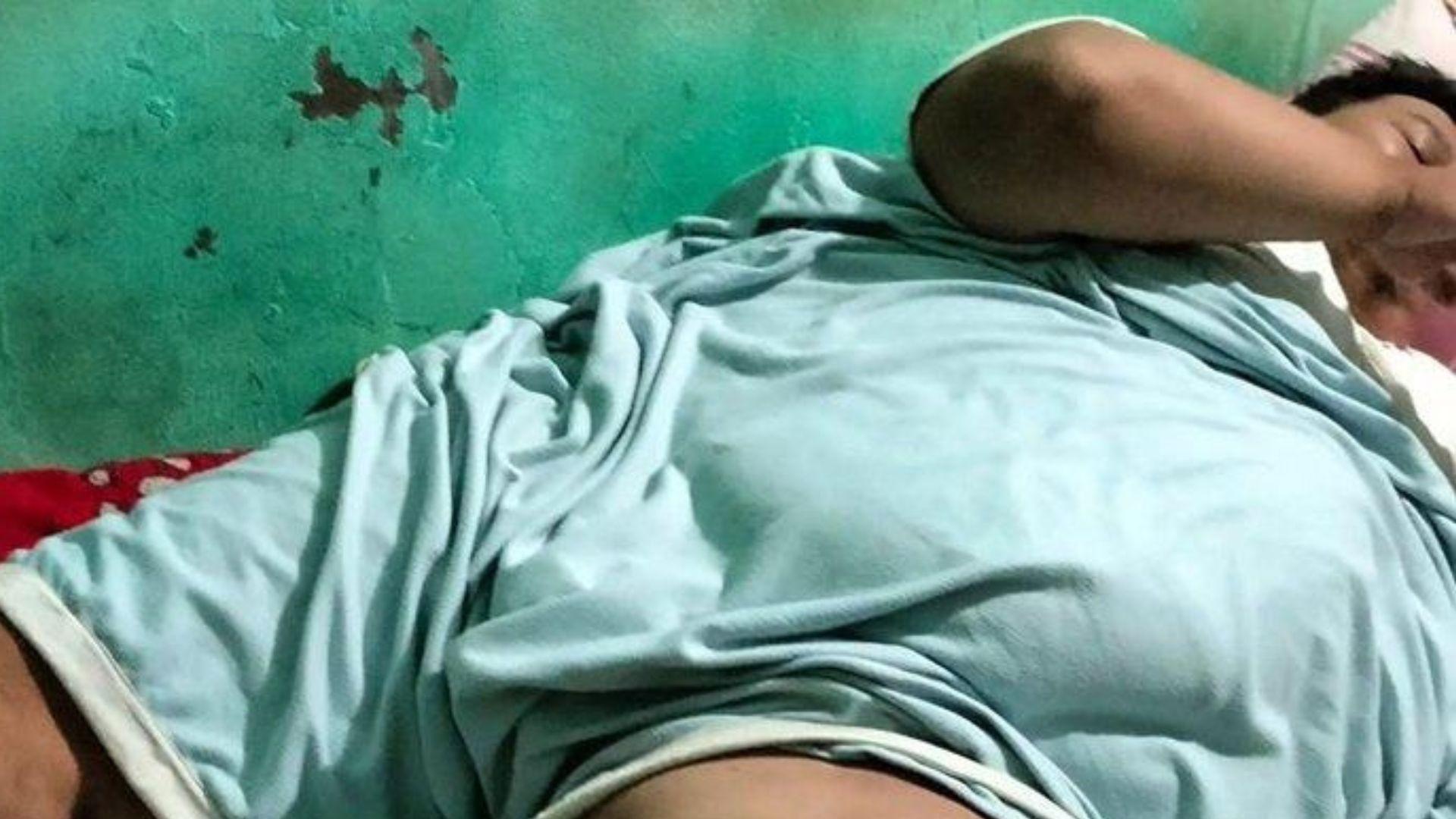 Sosok Engky Pria Obesitas Berbobot 200 Kg di Tanggerang, Tukang Ojek Jadi Tulang Punggung ...