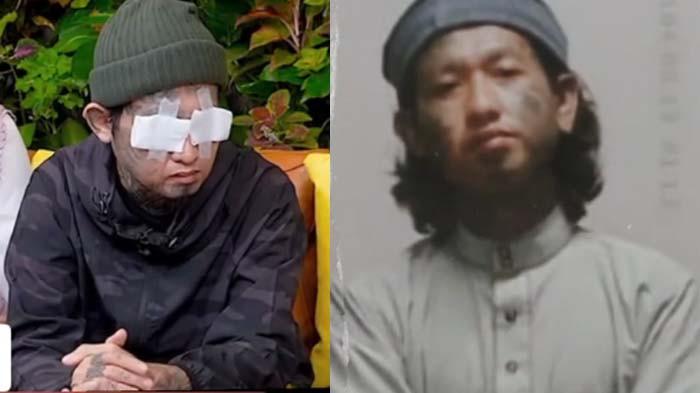 Misteri Meninggalnya Icang Faisal Korban Congkel Mata di Bogor, Sempat ...