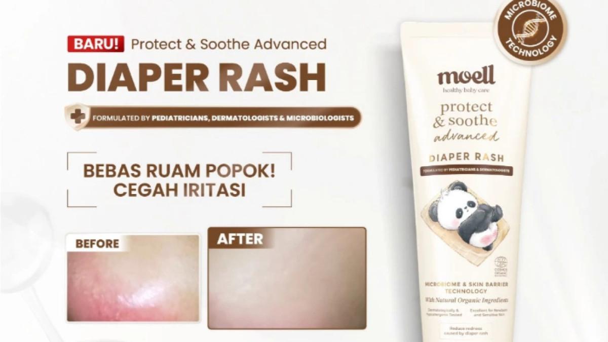 Berita Moell Diaper Rash Advanced Terbaru Hari Ini - TribunHealth.com