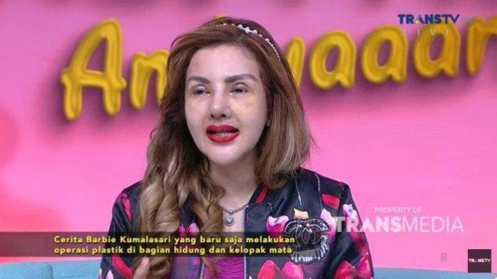Penampilan Baru Barbie Kumalasari, Sudah 9 Kali Oplas hingga Habis Miliaran, Terungkap Tujuannya ...