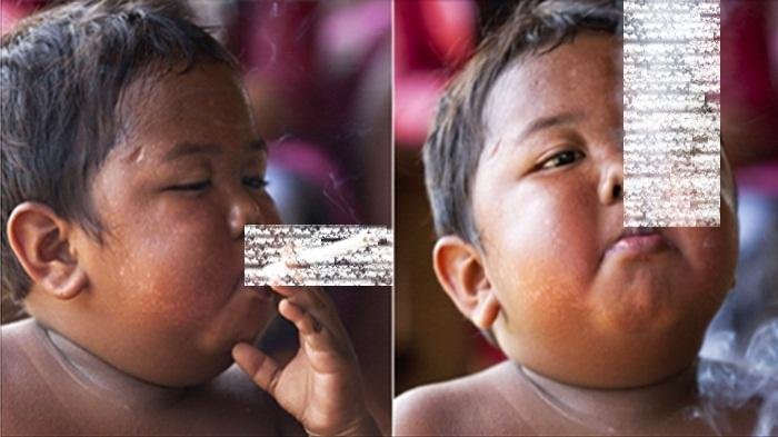 Masih Ingat Ardi Rizal? Balita Viral Habiskan 40 Batang Rokok Sehari, Kini Sukses Atasi ...