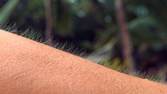 Alasan Bulu Kuduk Berdiri saat Sedang Ketakutan, Refleks Tubuh hingga ...