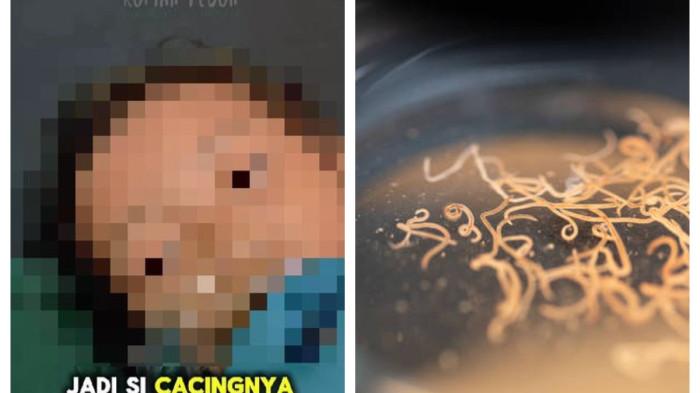 5 Fakta Lengkap Tragedi di Sukabumi Balita Raya Meninggal Akibat Cacingan: Kasus Paling Parah ...