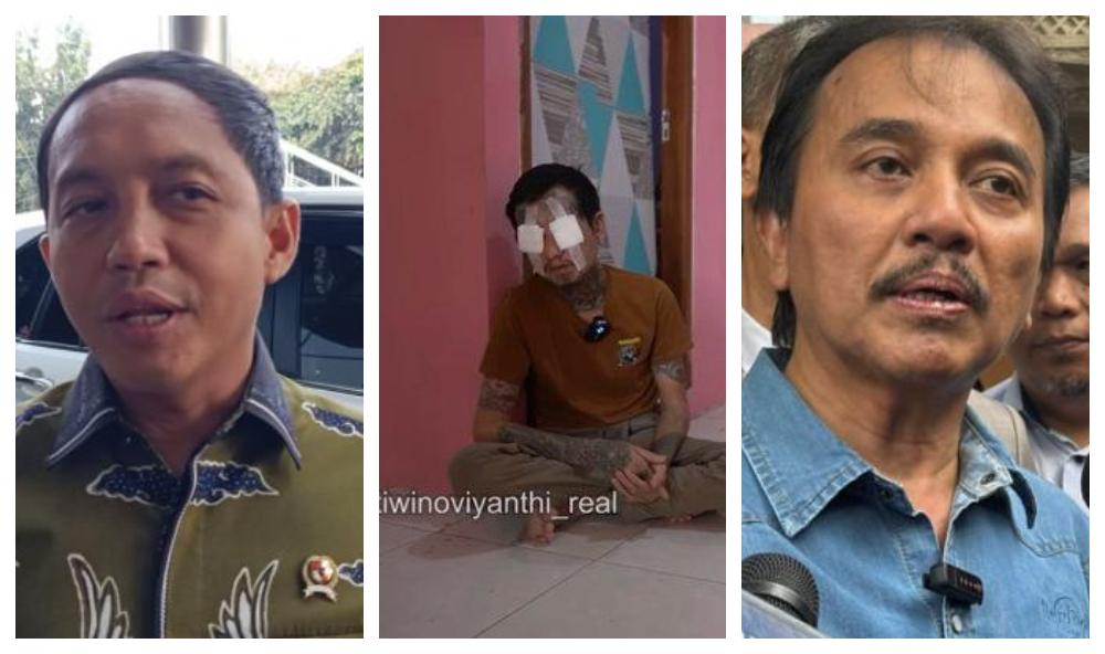 TOP 3 Berita Viral Tribun Jakarta: Icang Faisal Korban Congkel Mata ...