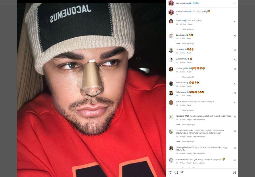 Ivan Gunawan Disebut Mirip Justin Bieber Pasca Operasi Hidung, Warganet ...