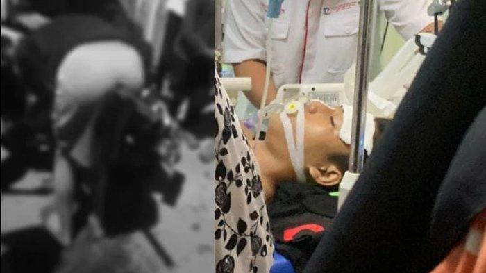 Insiden Dubur Remaja Robek Tertusuk Balok Kayu Saat Terjatuh dari Atap ...