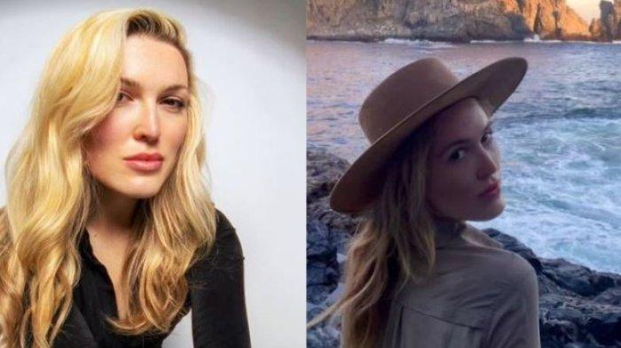 Profil Olivia Nuzzi, Reporter Majalah yang Diberhentikan Usai Ungkap ...