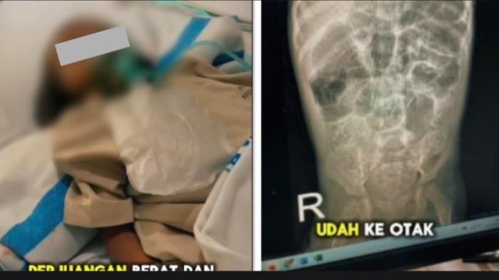 7 Fakta Terkini Balita di Sukabumi Meninggal dengan Tubuh Dipenuhi Cacing, Terungkap Dugaan ...
