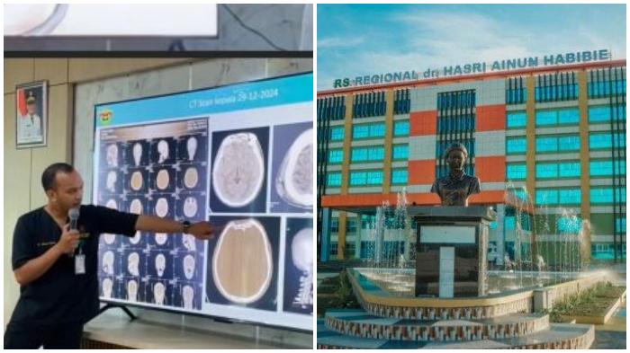 RS Hasri Ainun Habibie Parepare Tangani 146 Operasi Bedah Otak Dalam ...