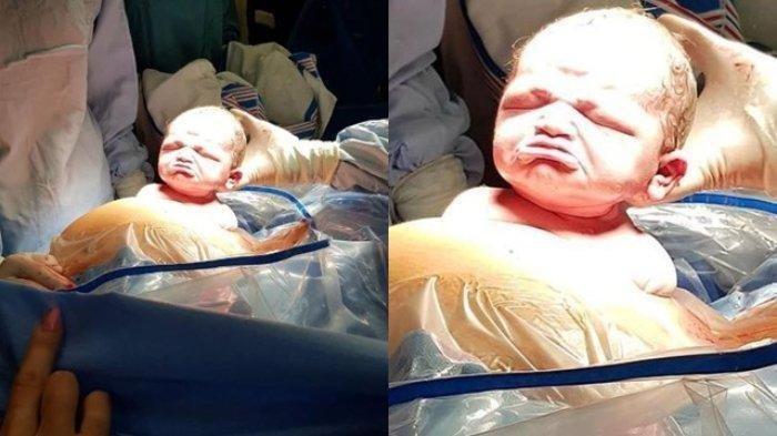 Ingat Bayi Perempuan Lahir Dengan Wajah Cemberut? Lihat Wajahnya ...