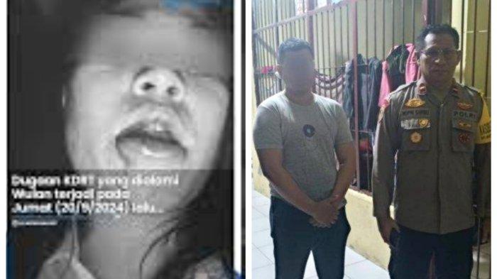 KRONOLOGI Ibu Bhayangkari Ngaku Dianiaya Brigpol RZE: Dicekik ...