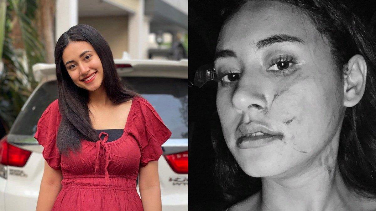 SOSOK Selebgram Afifah Riyad, Babak Belur Dihajar Mantan Pacar Suami ...