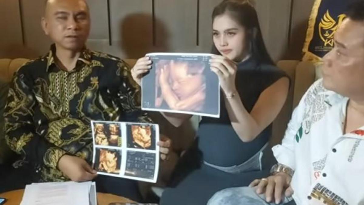 Sosok Friceilda Prillea, TikToker yang Mengaku Dihamili Artis Anrez Adelio, Usia Kandungan 8 ...