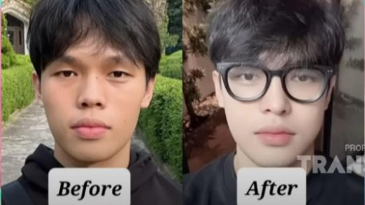 Selebgram Ini Habiskan 800 Juta untuk Oplas Wajah, Sempat Sedih Saat ...