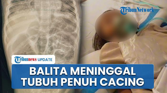Bocah Meninggal karena Tubuh Penuh Cacing di Sukabumi, Kisah Menyayat Hati - Halaman all ...
