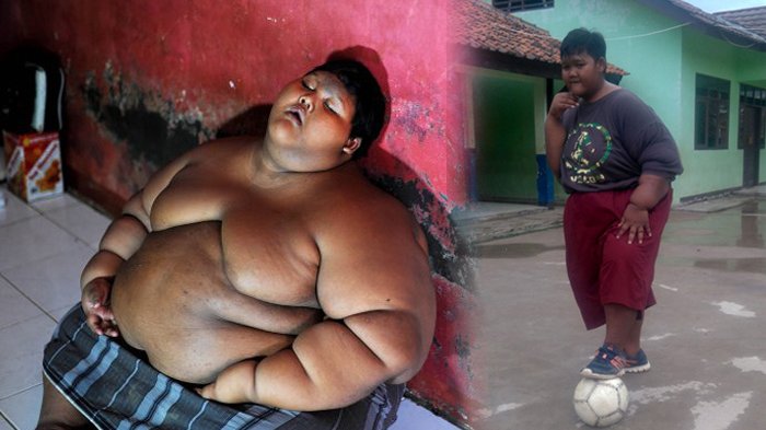 Jadi Sorotan Dunia! Perubahan Drastis Tubuh Arya Permana, Ini Proses ...