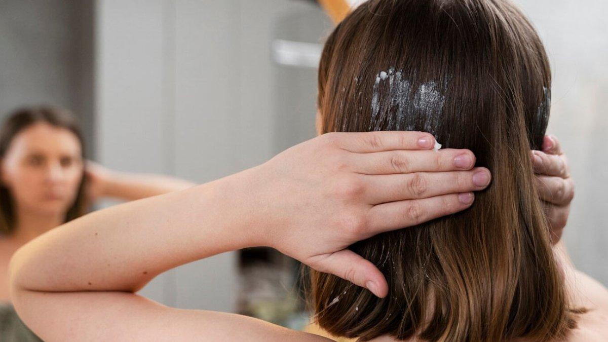 3 Tips Memakai Minyak Kelapa untuk Atasi Kulit Kepala dan Rambut Kering ...