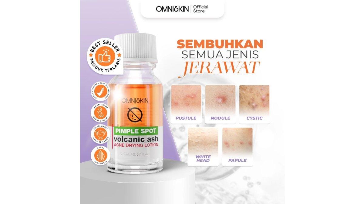 4 Rekomendasi Acne Spot Drying Lotion, Bubuk Sulfur yang Unik untuk ...