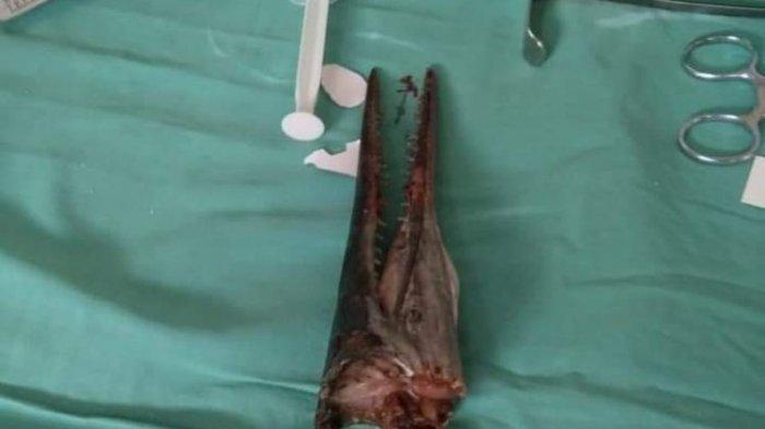 Kisah Dokter Keluarkan Moncong Ikan Marlin dari Leher Korban yang ...