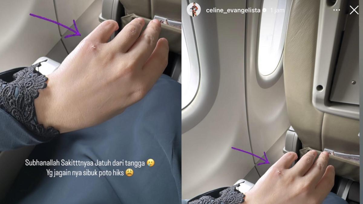 Detik-detik Insiden Celine Evangelista Jatuh dari Tangga Pesawat ...