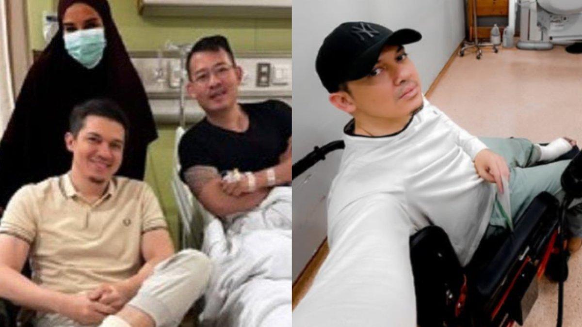 Kondisi Irwansyah Usai Jatuh dari Kuda, Tulang Kaki Suami Zaskia ...