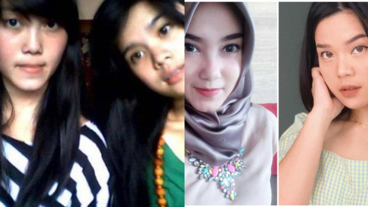 VIDEO Sinta dan Jojo Keong Racun yang Dulu Viral, Kini Muncul Lagi di TV, Begini Nasib Mereka ...