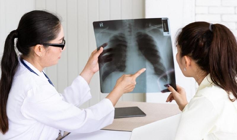 Apa Itu CT Scan Low Dose? Mampu Deteksi Dini Kanker Paru, Radiasi Lebih ...