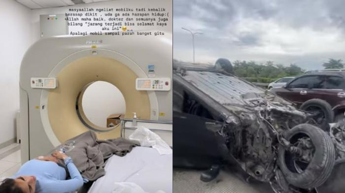 Mobil Hancur Model Diva Siregar Selamat Dari Kecelakaan Maut Dokter
