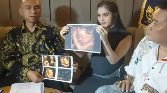 Sosok Friceilda Prillea, Kekasih Aktor Anrez Putra Adelio Ngaku ...