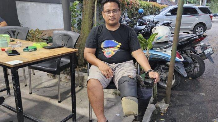 VIDEO Pilunya Dimas Kurir Paket Dipecat, Kaki Diamputasi Kecelakaan ...