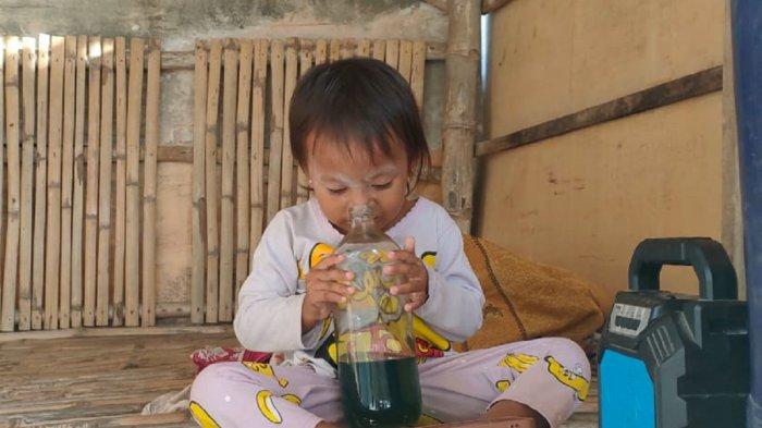Bocah Berusia 4 Tahun di Sampang Kecanduan Menghirup Aroma Bansin Selama Setahun - Suryamalang.com