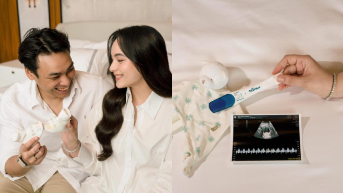 Chelsea Islan Hamil Anak Pertama, Istri Rob Clinton Bagikan Potret Baby ...