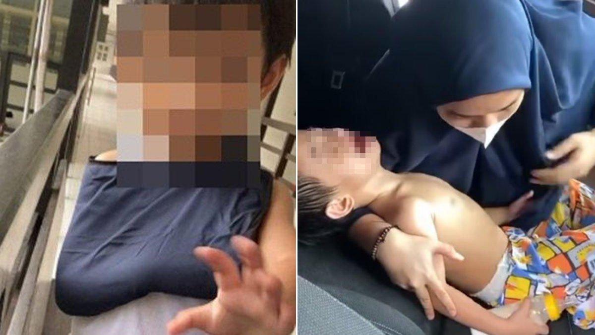 MENYEDIHKAN Kondisi Bocah PAUD yang Dianiaya Guru hingga Patah Tulang, Trauma dengar Lagu TK ...