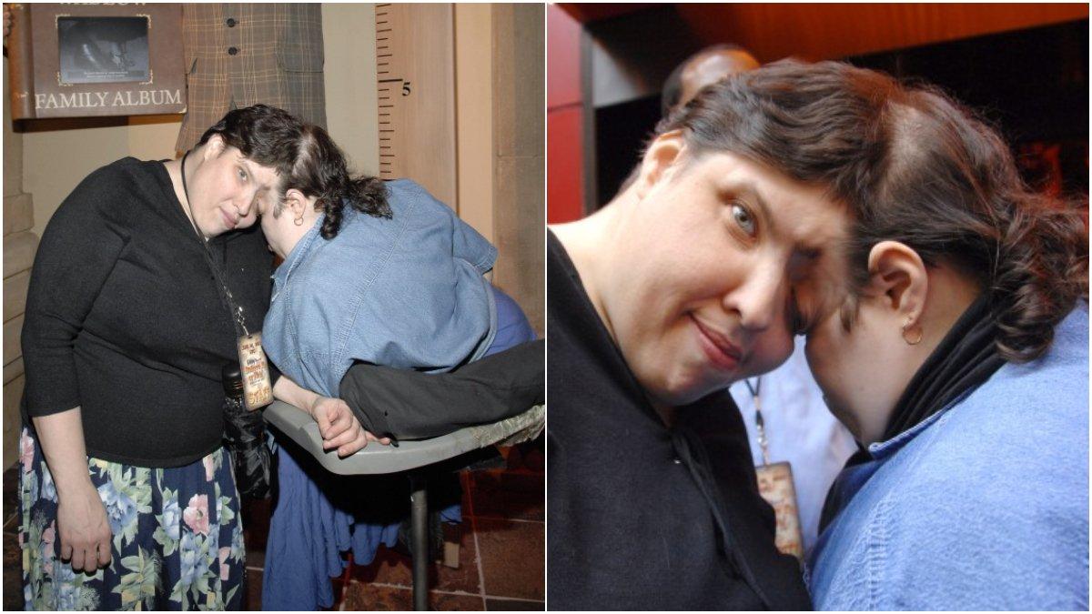 Wanita Kembar Siam Bongkar Urusan Ranjang, Saudara Laki-lakinya Diam saat Dia Bercinta: Baca ...