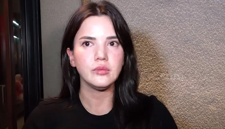 Alice Norin Ungkap Pengalaman saat Jalani Operasi Pengangkatan Kanker ...