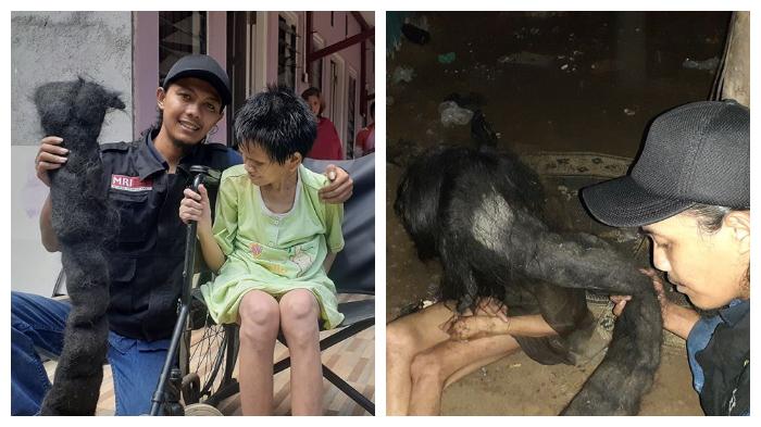 Kisah Relawan ACT Selamatkan SI Rambut Gimbal Sukiyah yang Tak Keramas ...