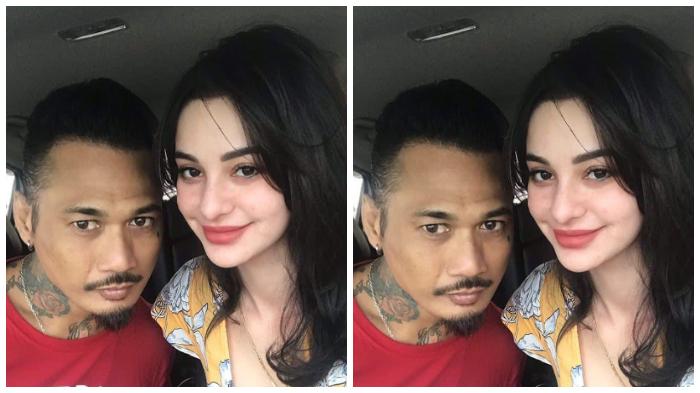 Operasi Sebelum Program Bayi Tabung, Nora Alexandra Tak Temani Jerinx ...