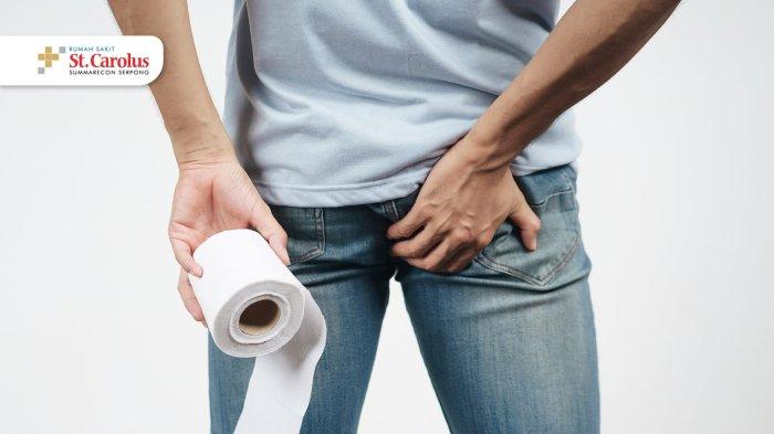 Wasir Bisa Sembuh Lebih Cepat dengan Teknologi Laser Hemorrhoidoplasty ...
